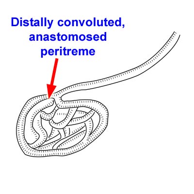 Feature: Terminus of peritremes | Invasive Mite ID