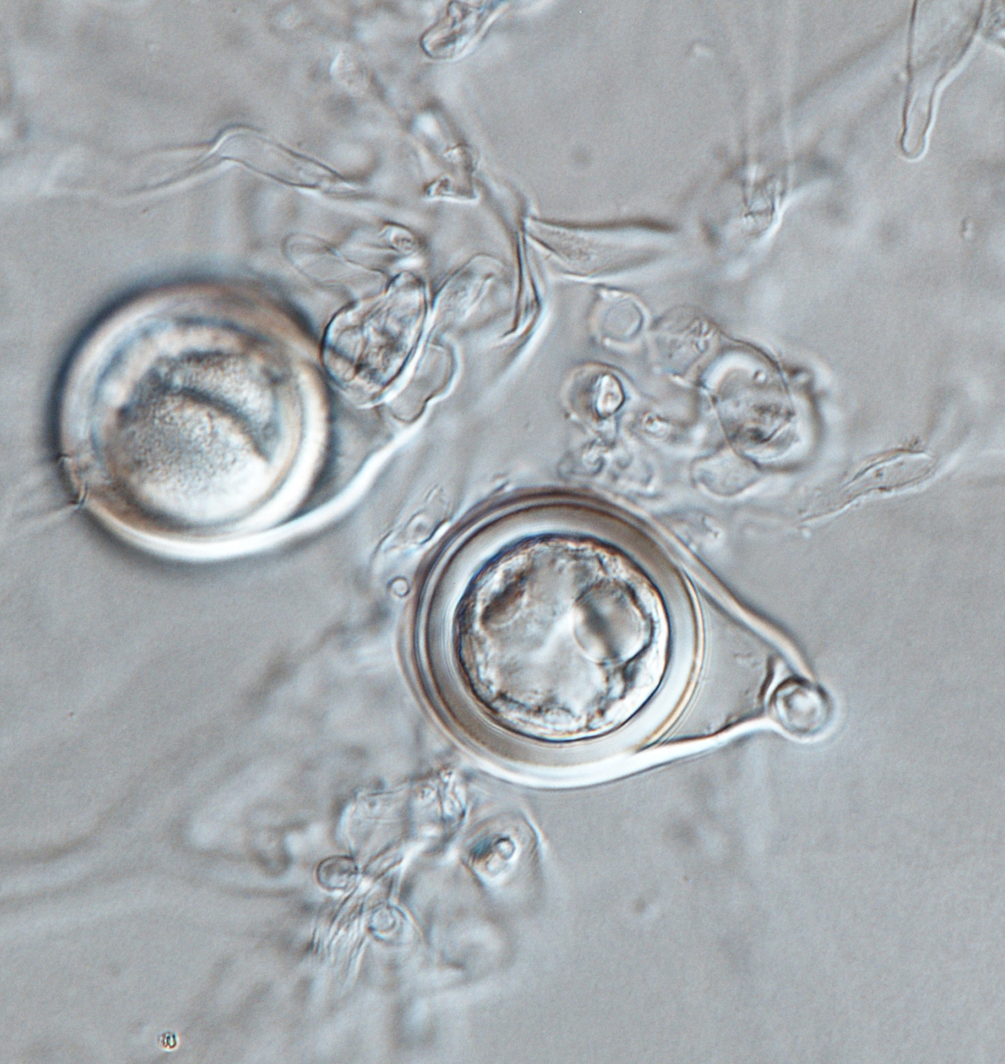 Phytophthora foliorum | IDphy