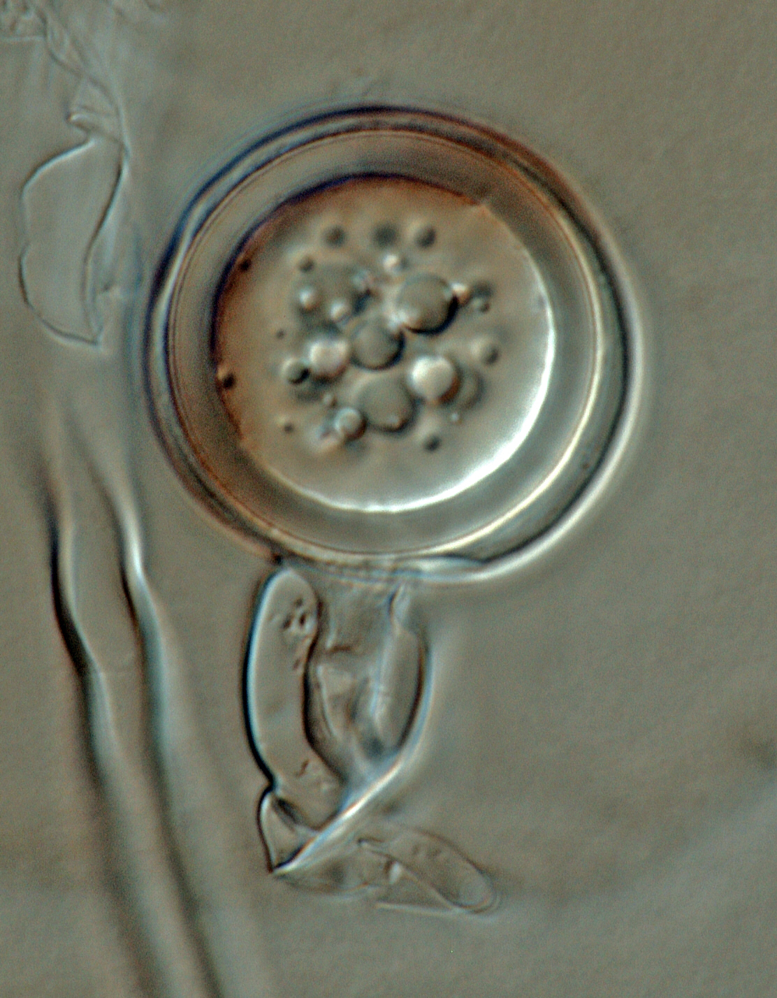 Phytophthora niederhauserii | IDphy