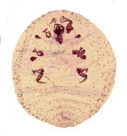 Dactylopius coccus | Scale Insects