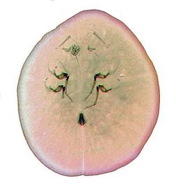 Kilifia deltoides | Scale Insects