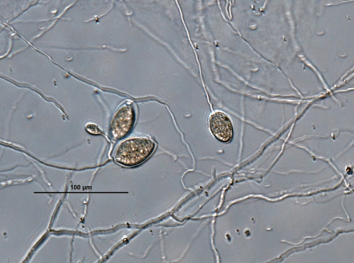 Phytophthora erythroseptica (in progress - Abad et al. 2023b) | IDphy
