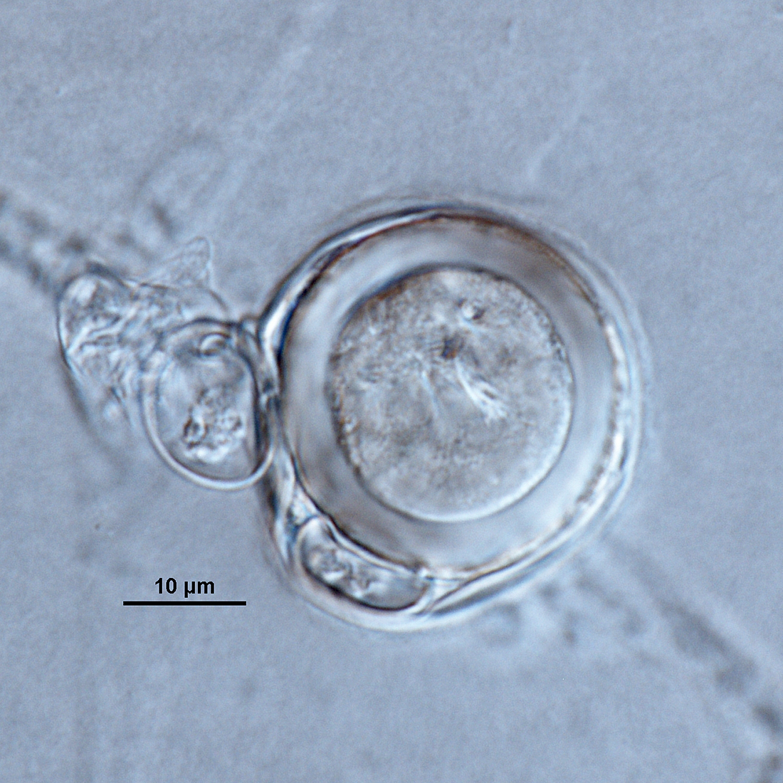 Phytophthora occultans | IDphy
