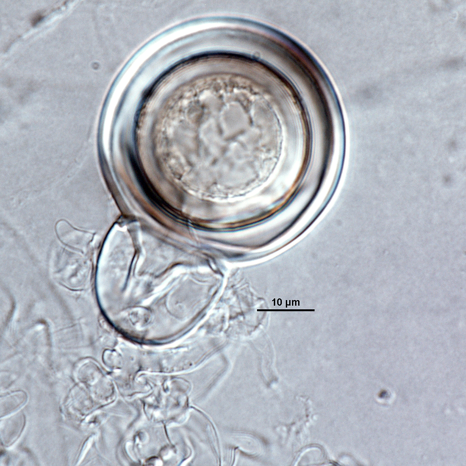 Phytophthora pisi (in progress - Abad et al. 2023b) | IDphy