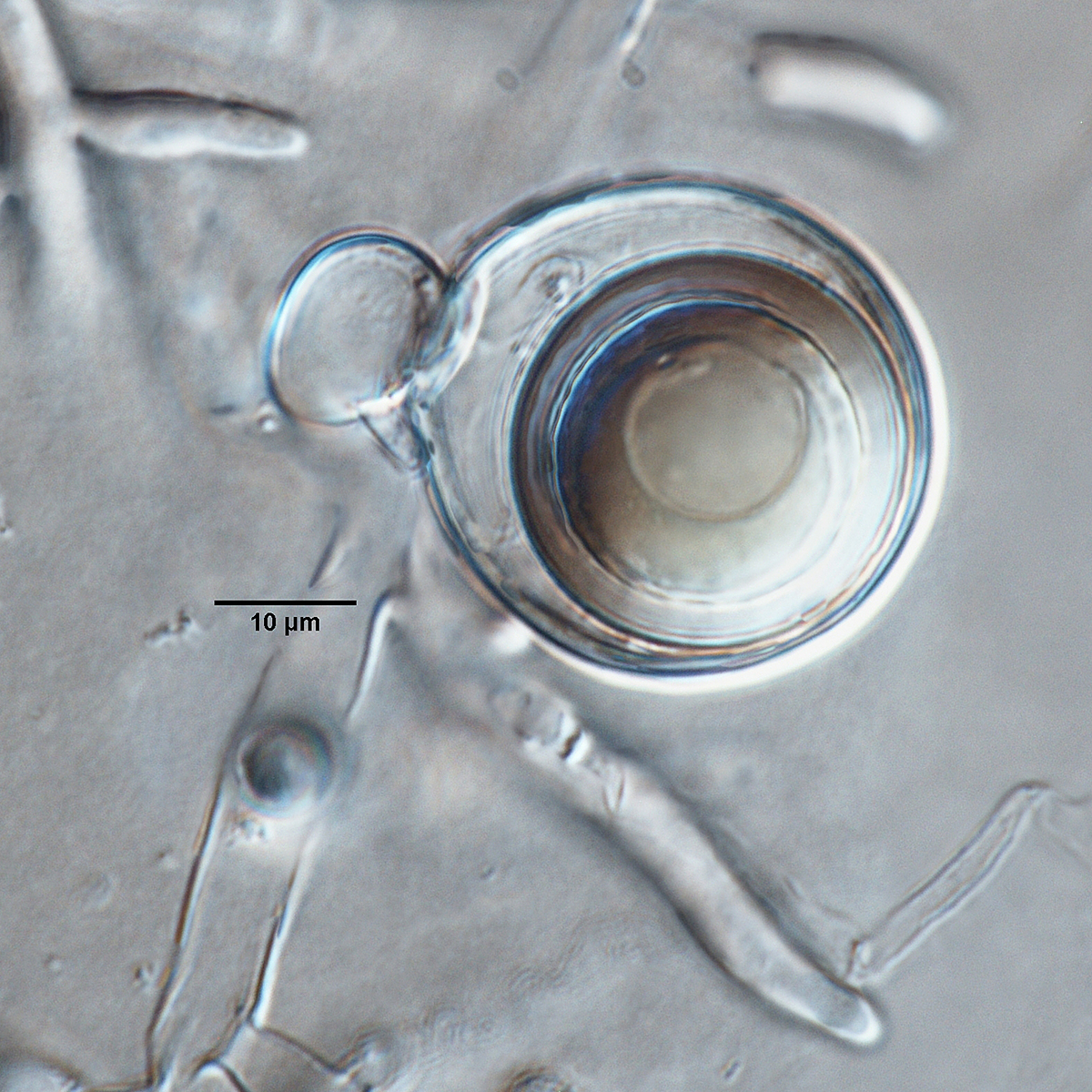 Phytophthora sojae (in progress - Abad et al. 2023b) | IDphy