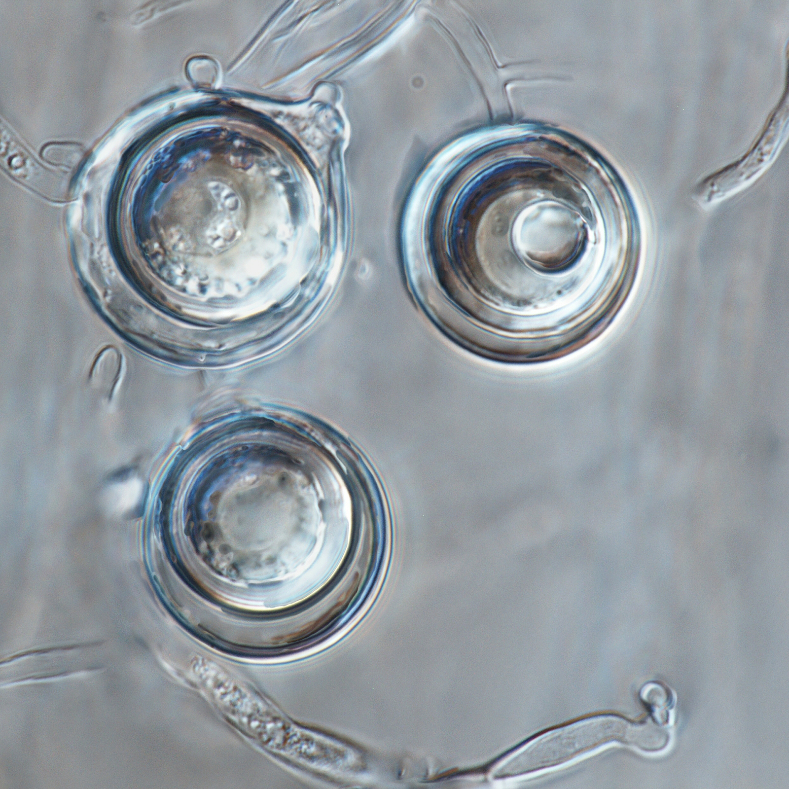 Phytophthora sojae (in progress - Abad et al. 2023b) | IDphy