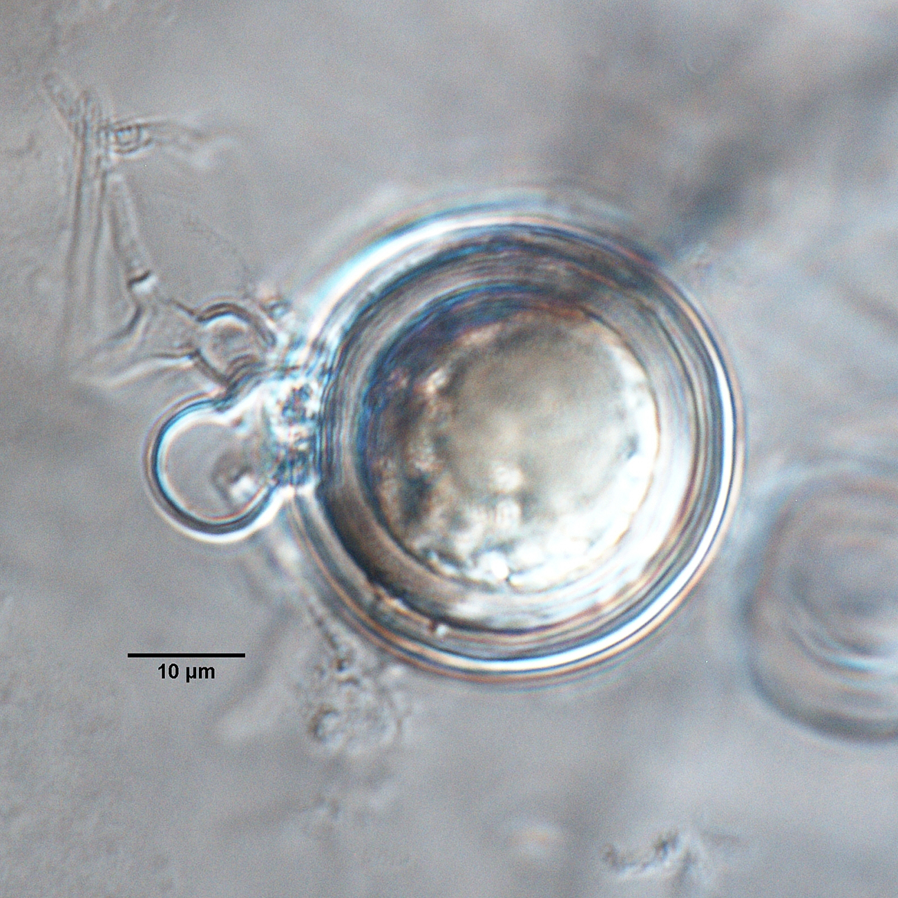 Phytophthora sojae (to be redescribed 2022) | IDphy