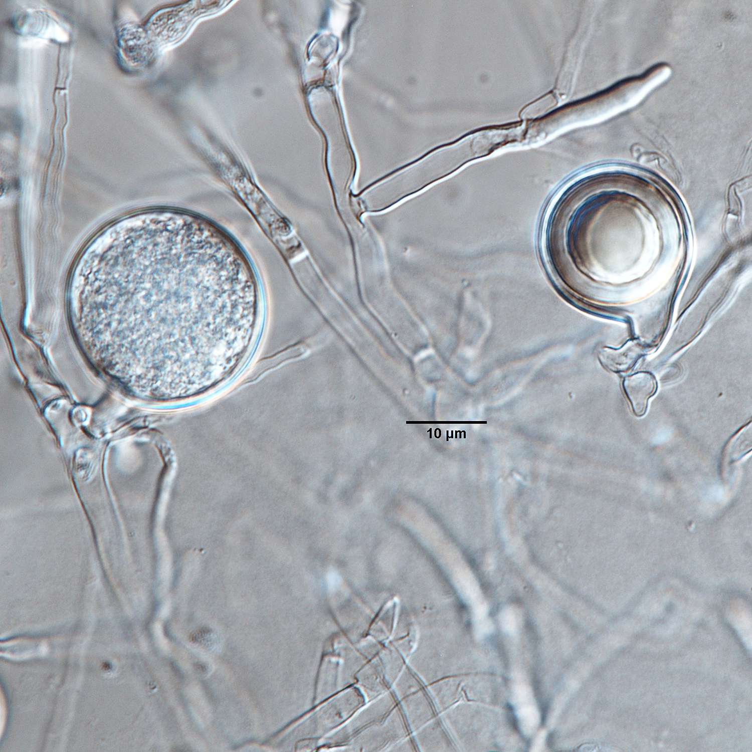 Phytophthora sojae (to be redescribed 2022) | IDphy