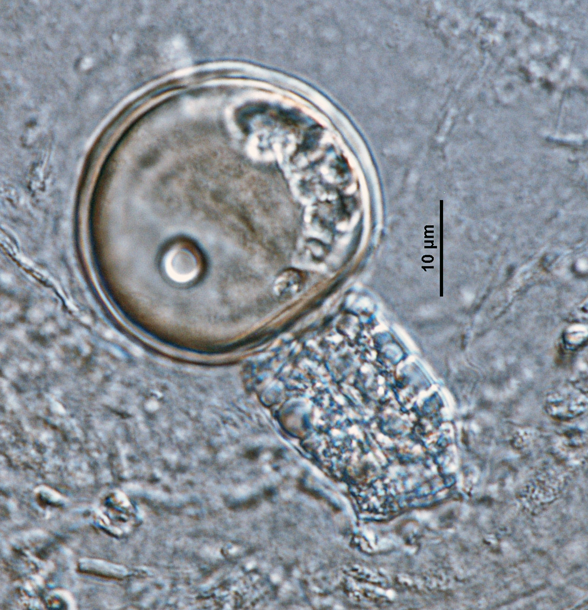 Phytophthora Infestans Microscope