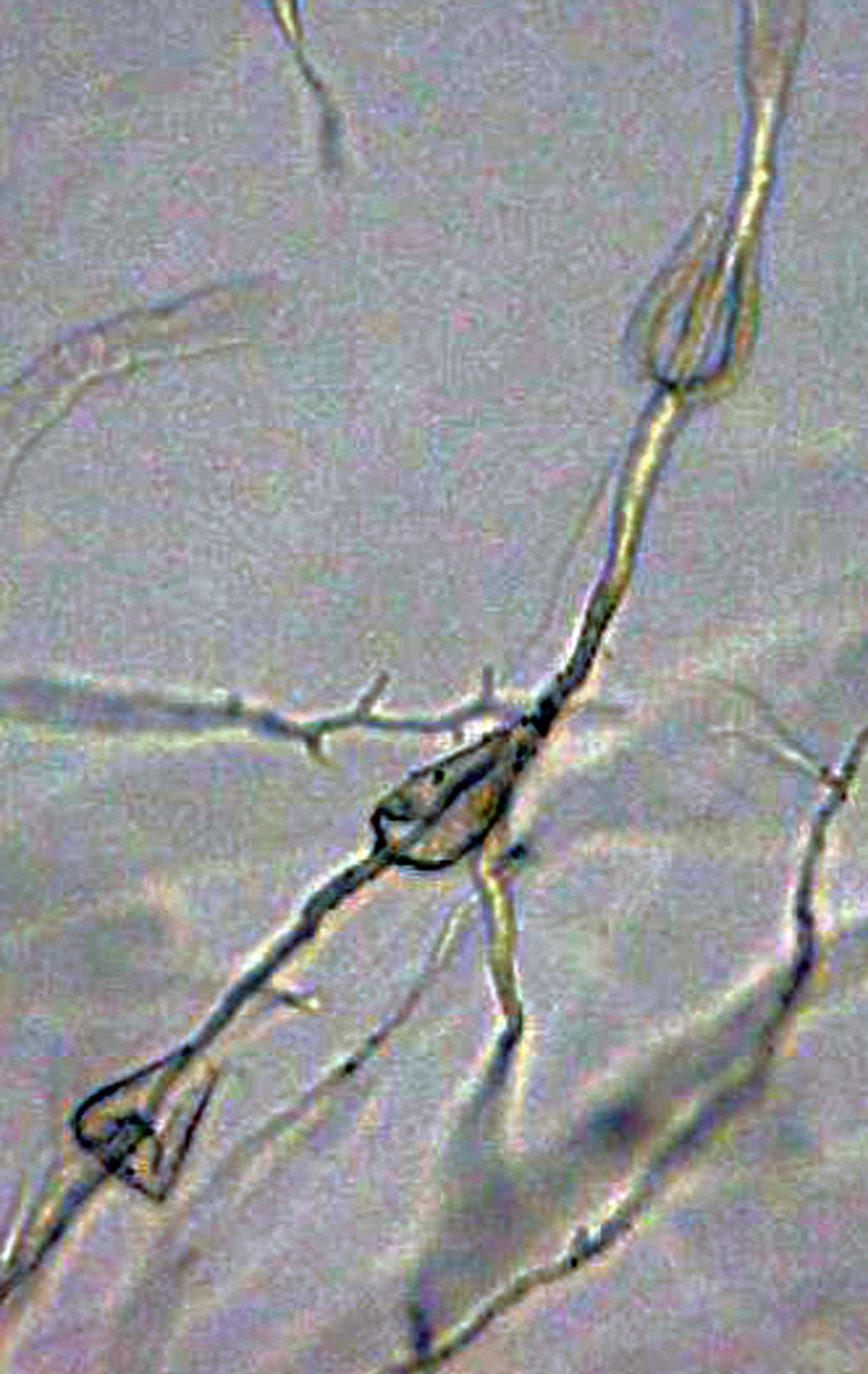 Phytophthora lilii | IDphy