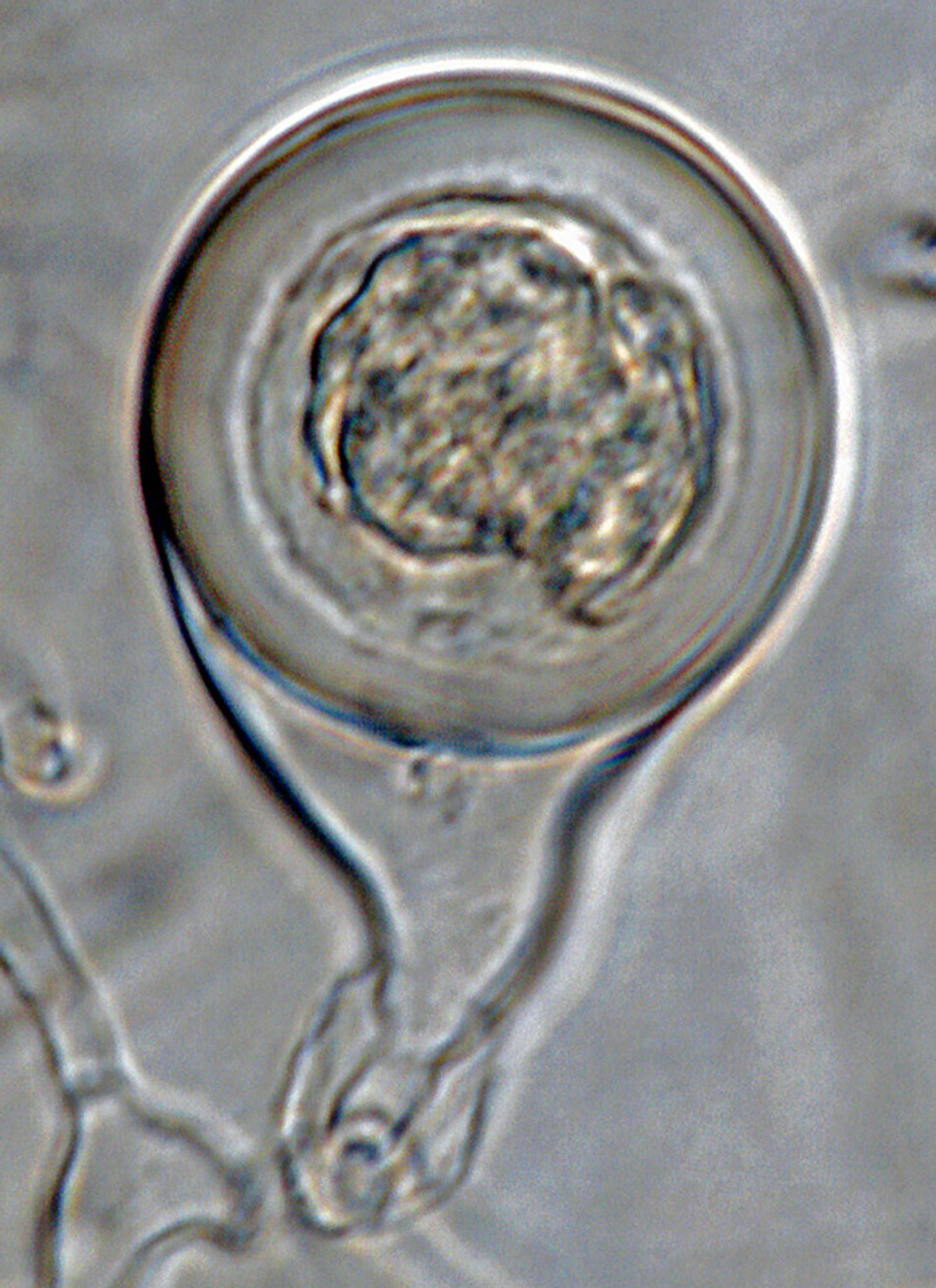 Phytophthora morindae | IDphy