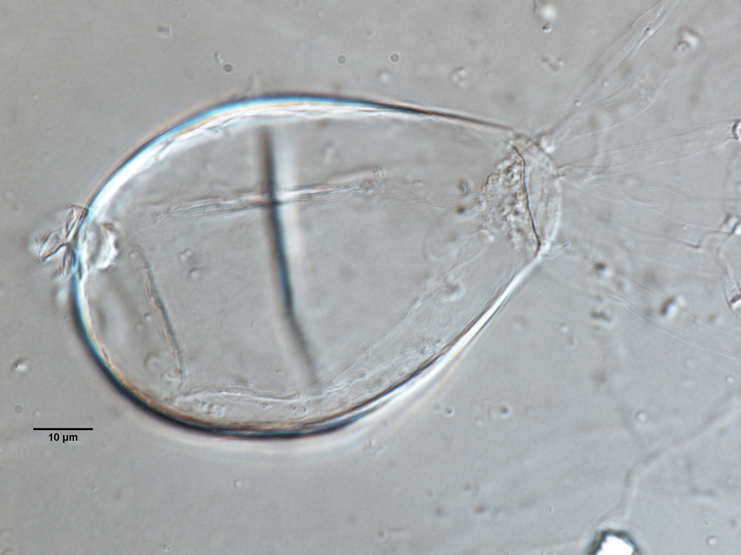 Phytophthora sojae (in progress - Abad et al. 2023b) | IDphy