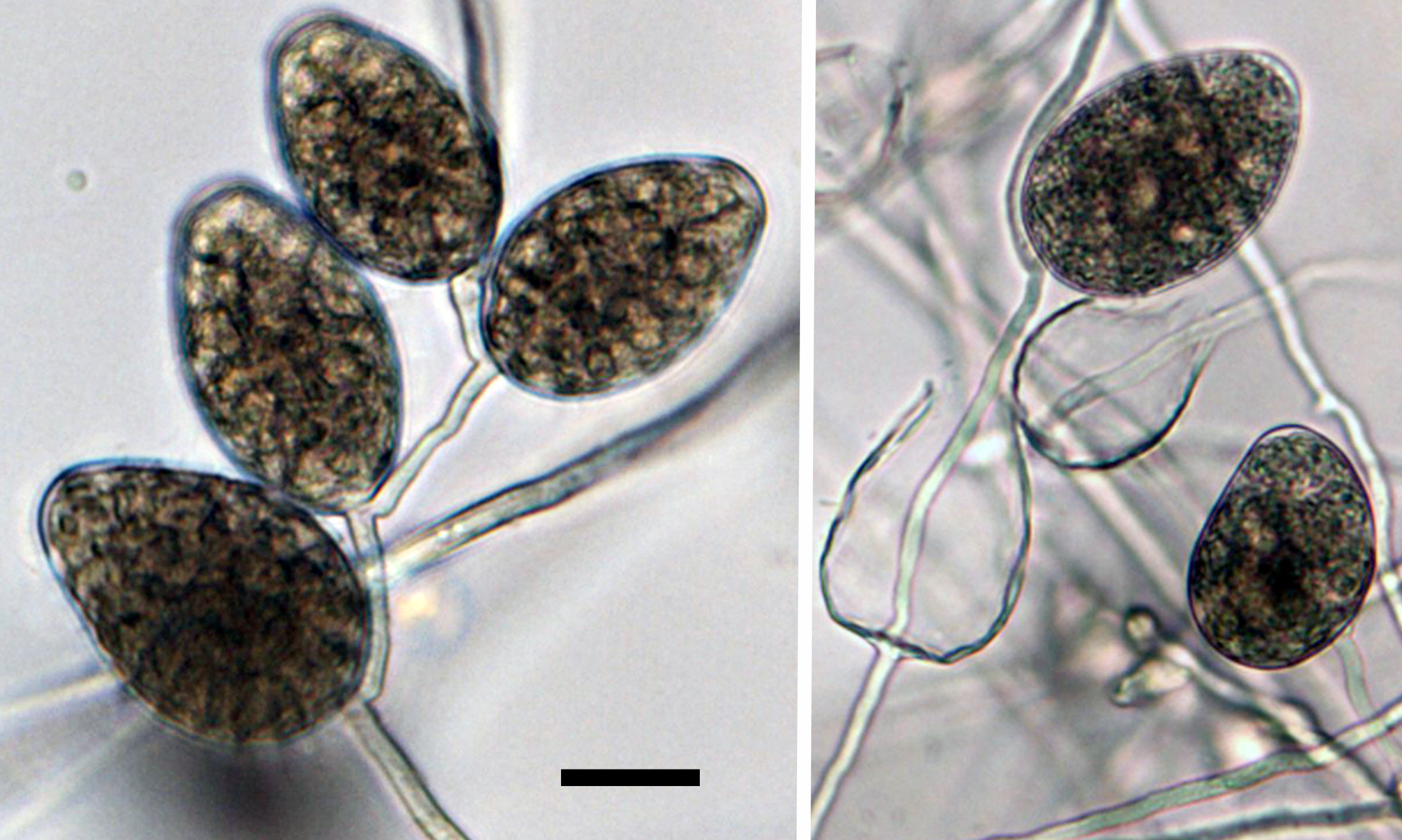 Phytophthora kelmanii | IDphy